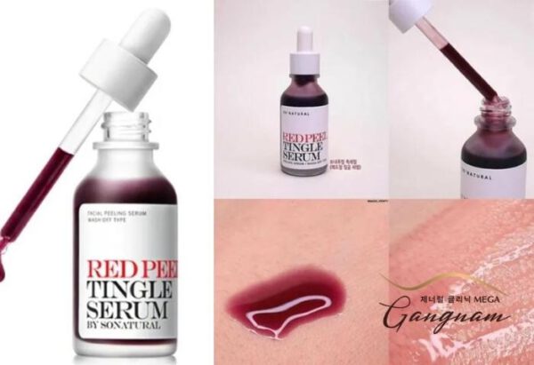 Sử dụng Red peel đúng cách, chuẩn y khoa như thế nào?