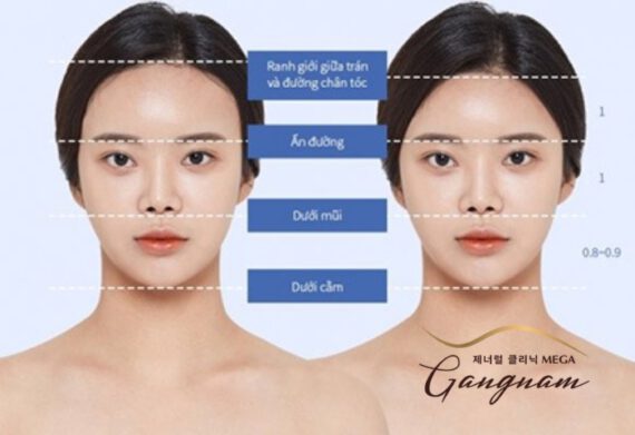 Trán cao tướng có tốt không? Có nên can thiệp thẩm mỹ không?