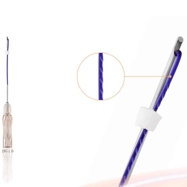 What is PCL thread lifting? What are its uses, advantages and ...