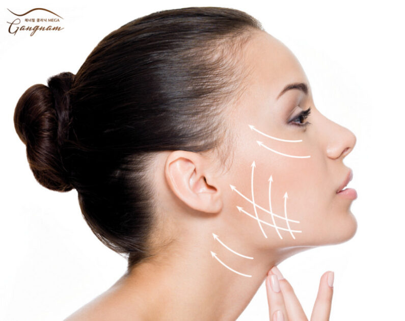 5 lợi ích tuyệt vời khi căng da mặt bằng chỉ collagen