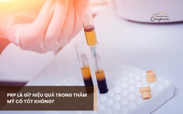 PRP là gì? Hiệu quả trong thẩm mỹ có tốt không?